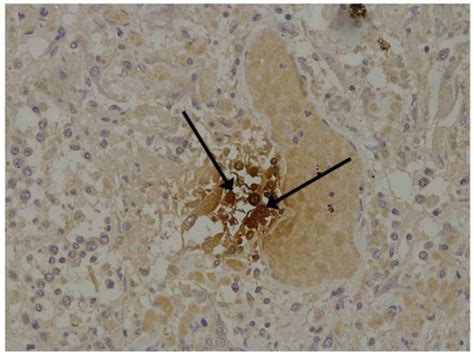 Pathophysiology Special Issue Pathophysiology Of Autoimmune Diseases