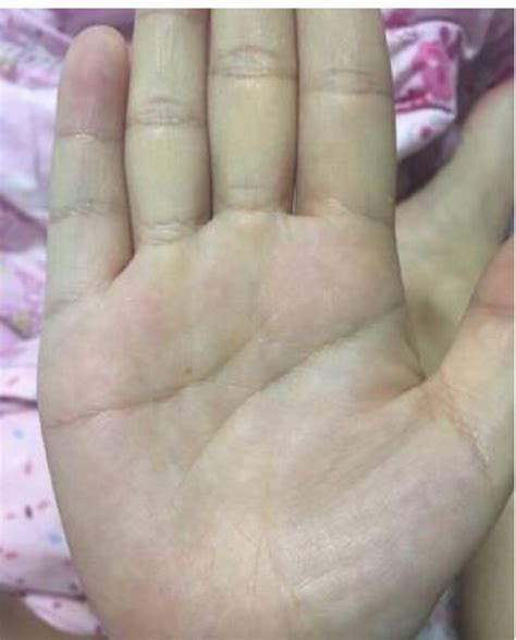 二婚手相头婚丧偶二婚幸福手相有两次婚姻的手相图片大山谷图库