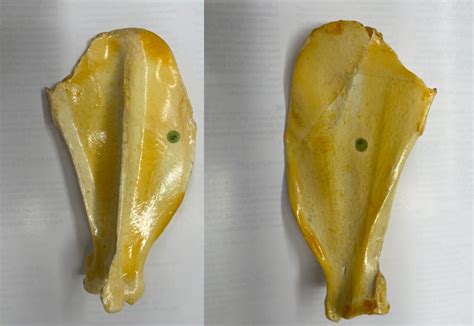 Scapula Diagram Quizlet