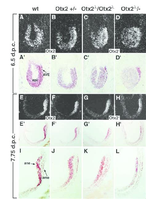 Distribution Of Otx2 λ Mrna And Protein During Gastrulation A L