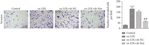 Effects Of Xist On Proliferation Migration And Invasion Of Ox Ldl