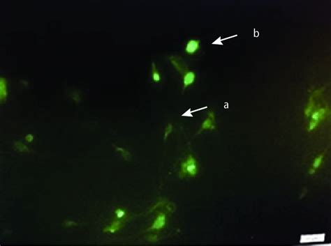 Evaluation Of Apoptosis In Sperm By A Tunel Assay A Sperm With Normal