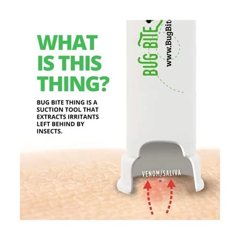 Bug Bite Thing Suction Tool Poison Remover Bug Bites And Beewasp