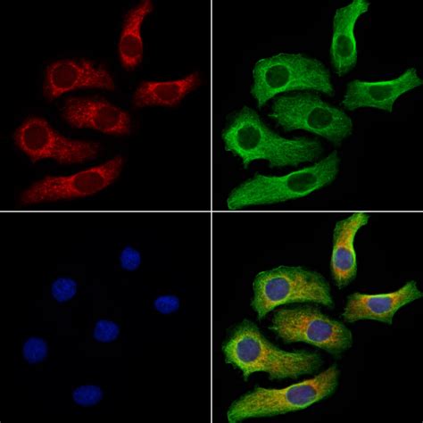 Nesprin 1 Antibody Pa5 115640