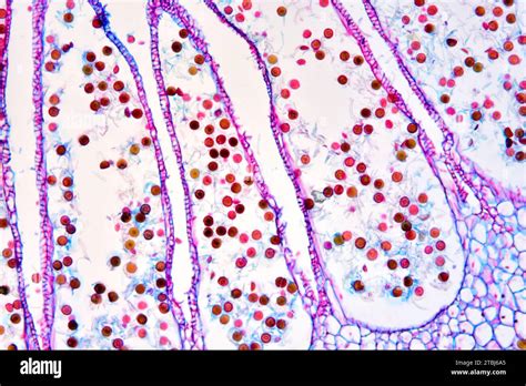Strobilus Of Equisetum Sp With Spores Optical Microscope X100 Stock