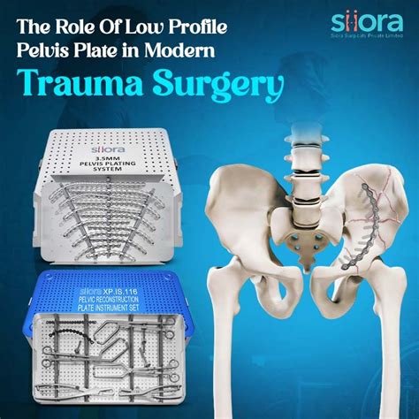 How Orthopedic Implants Work A Comprehensive Overview