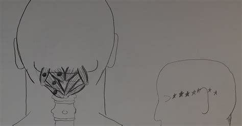 Trigger Points Suboccipital Muscles Trigger Points Suboccipital Muscles