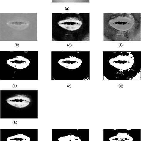 A Original Lip Image 1 B Membership Distribution Obtained By Ct Download Scientific