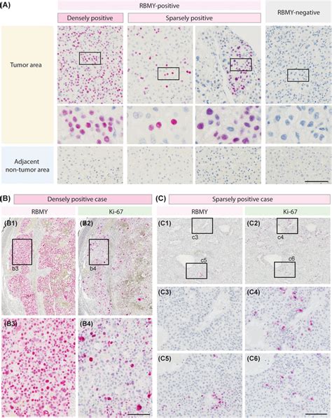 Differential Expression Of Rna‐binding Motif Y Rbmy In Male