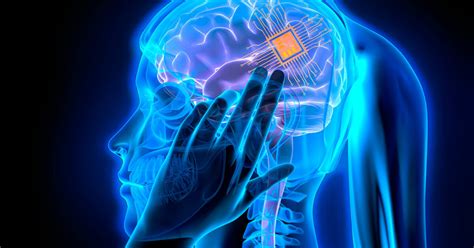 Elon Musk Y Neuralink Implantes Neuronales Y ¿ciberseguridad