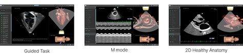New Pediatric Advanced Echo Module Coming Soon Surgical Science