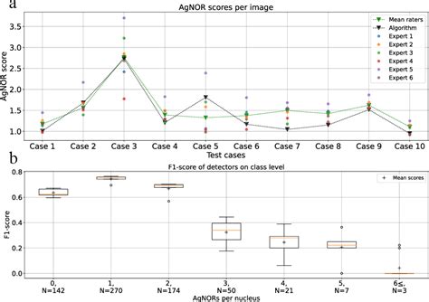 Deep Learning Based Automatic Assessment Of AgNOR Scores In