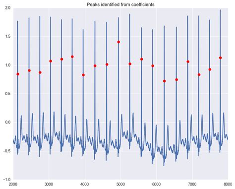 Electrocardiograms Qrs Detection Using Wavelet Analysis By Andrew