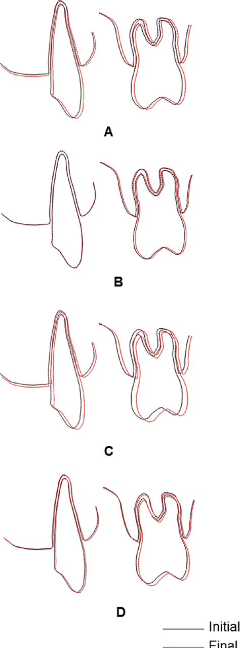 Figure 10 From Stress Distribution And Displacement By Different Bone Borne Palatal Expanders