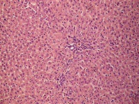 Shr Rat Liver Combined Long Term Therapy Ramipril And Corvitin Download Scientific Diagram