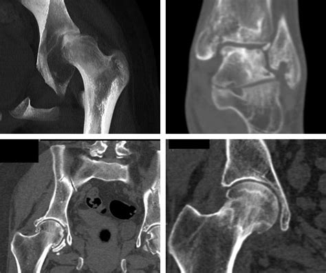 Ct Quick Guides Ct Scanning