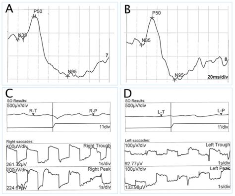 Electrophysiology Encompasses Several Objective Examination Techniques