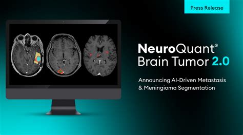 Cortechs Ai Announce Next Gen Neuroquant Brain Tumor Ai Driven