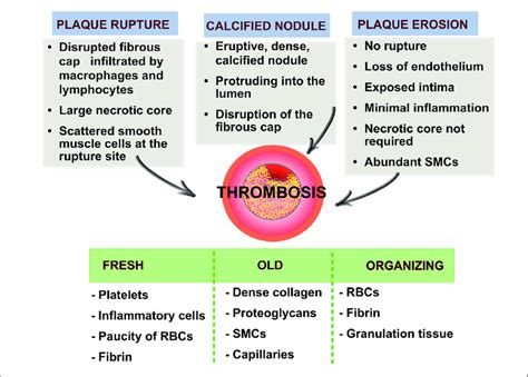 Pathogenesis Of Thrombosis In Sudden Cardiac Death Download Scientific Diagram