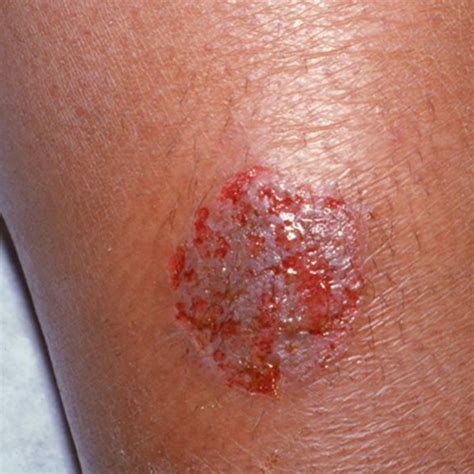 Maharania Skin Clinic