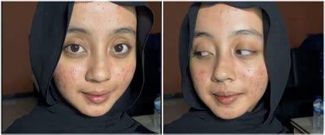 Transformasi Makeup Wanita Dengan Wajah Breakout Hasilnya Flawless