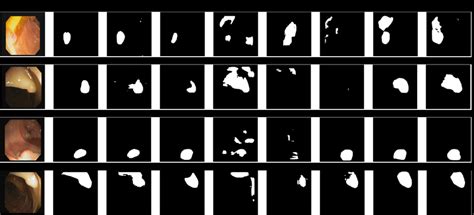 Qualitative Result Comparison Using CVC Colon For Training And Download Scientific Diagram