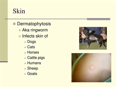 Ppt Fungal Diseases Powerpoint Presentation Free Download Id2406010