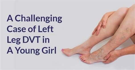 A Challenging Case Of Left Leg Dvt In A Young Girl Yashoda Hospitals