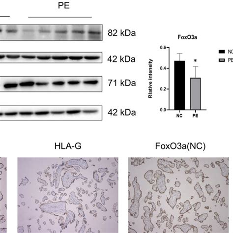 Expression And Distribution Of Foxo3a In Placental Tissues A Western