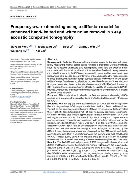 Frequency‐aware Denoising Using A Diffusion Model For Enhanced Band