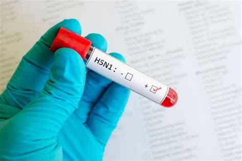 Gripe Aviar Qué Es Cómo Se Transmite Y Cuál Es El Riesgo Para Los Humanos