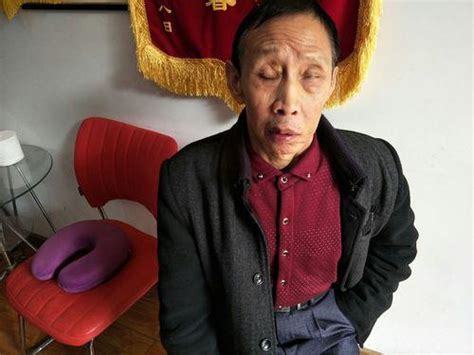 为什么面肌痉挛药物治疗无效？ 知乎