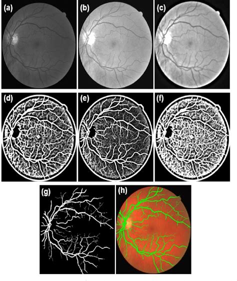 Figure 3 From An Automated Image Segmentation And Useful Feature Extraction Algorithm For