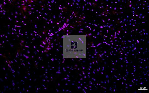 Ros活性氧 Dhe染色 含试剂 武汉百仟度生物科技有限公司 提供检测服务外包 服务改进 开发产品 武汉百仟度