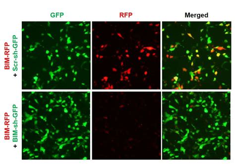 Validated Humanmouse Bim Bcl2l11 Shrna Lentivirus
