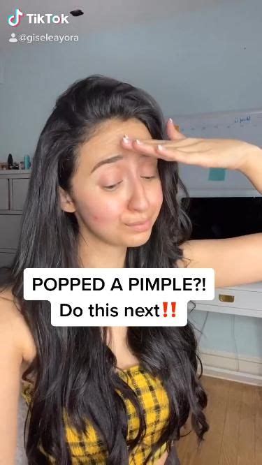 Pimple Solution😍 Healthy Skin Natural Skin Care Healthy Skin Tips