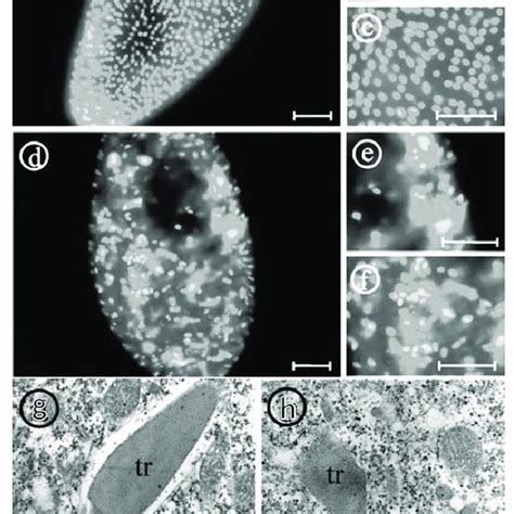 Pdf Trichocysts Parameciums Projectile Like Secretory Organelles