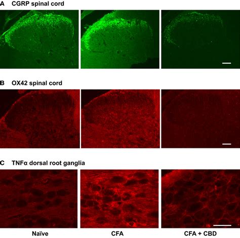 Immunocytochemical Localization Of Inflammatory Biomarkers A Cgrp