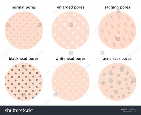 Enlarged Pores Over 114 Royalty Free Licensable Stock Vectors And Vector