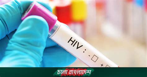 Sex Workers And Hiv In Bangladesh Bridging Gaps For A Safer Future