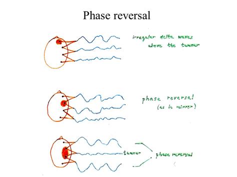 Electroencephalography—