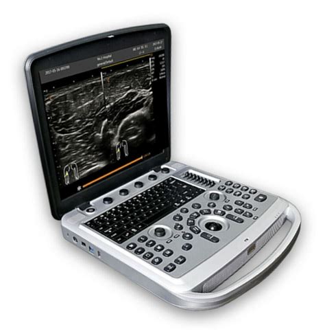Chison Sonobook 6 Vet Color Doppler Ultrasound With Rectal Probe Keebovet Veterinary