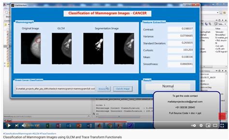 Classificationofmammogram Matlab Research Projects Facebook