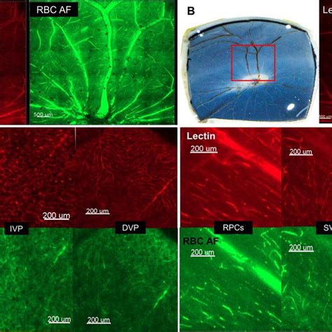 Tissue Staining Of Retinal Capillary Layers At Baseline A And 90 Mmhg