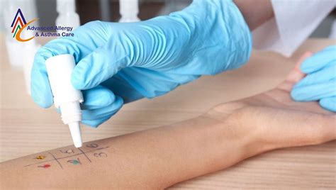Types Of Skin Allergen Test And Their Accuracy