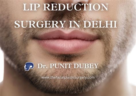 Lip Reduction Surgery In Delhi Lip Reduction Surgery Cost In Delhi