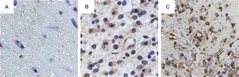 Figure 1 From The Expression Of Mmp19 And Its Clinical Significance In