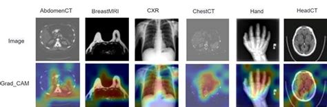 An Attention Based Residual Connection Convolutional Neural Network For Classification Of The