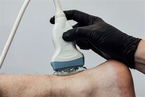 How To Cure Achilles Tendonitis Fast Prohealth Prolotherapy Clinic