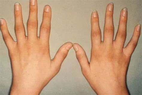 食指关节疼痛是什么样的预兆